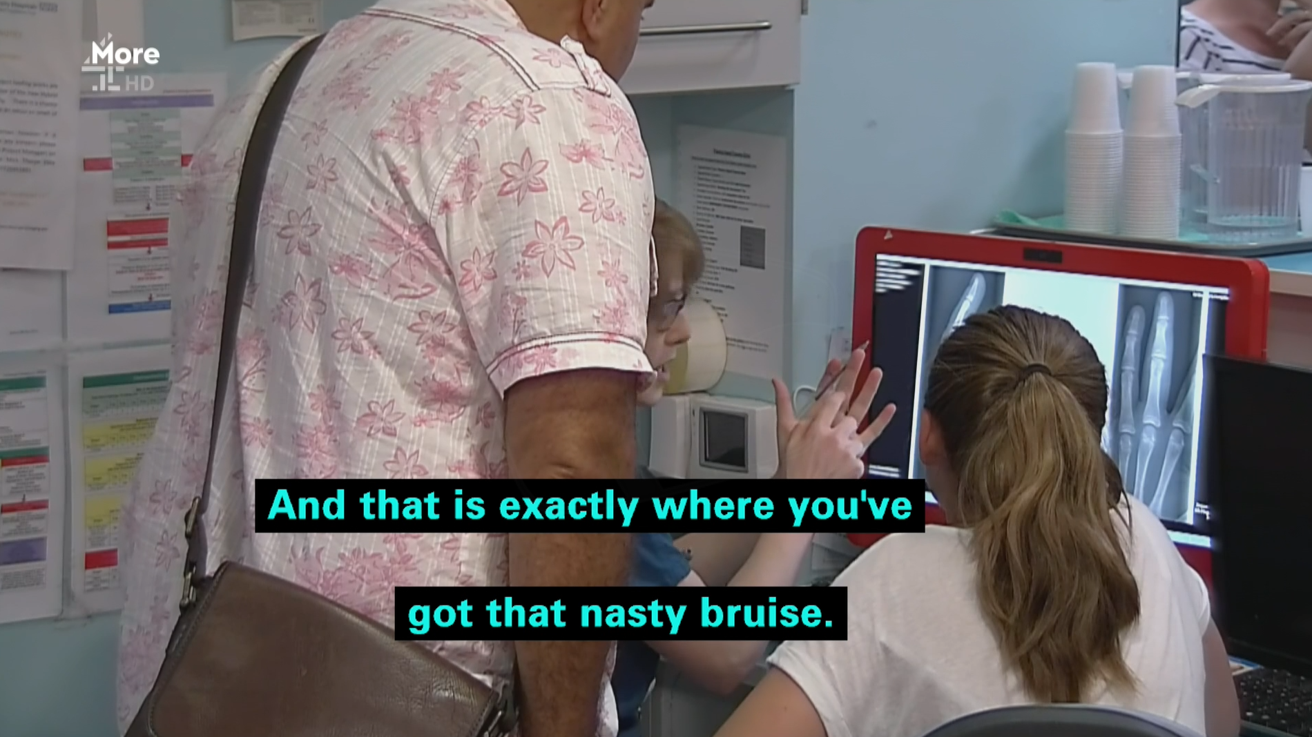 Evidence of subtitles returning to Channel 4 - Clean Feed